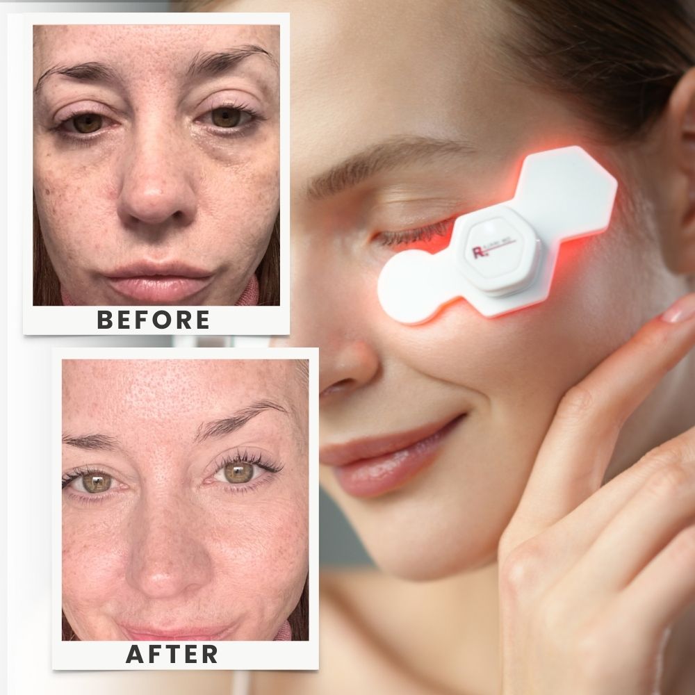 PlasmaGLO LED DUO UNDEREYE CORRECTOR