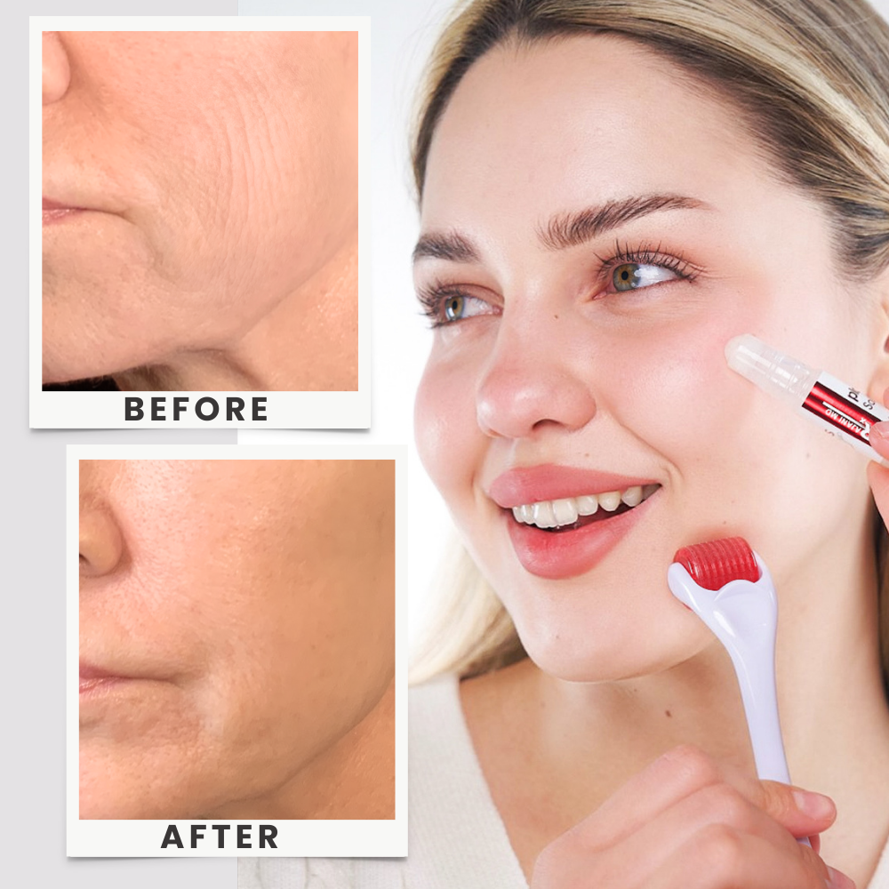 PlasmaSomes / Micro-Needle Kit 3 month supply